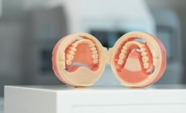 Digital Dentures | Classic Denture Studio | Dental Implants & Dental ...